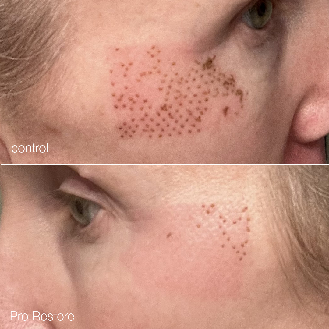 innovative pro formulas - Dermalogica PRO UK