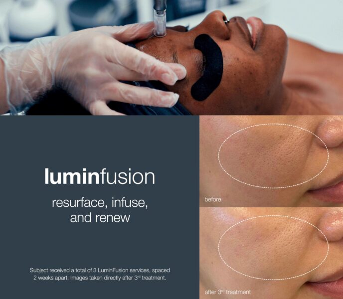 luminfusion - Dermalogica PRO UK