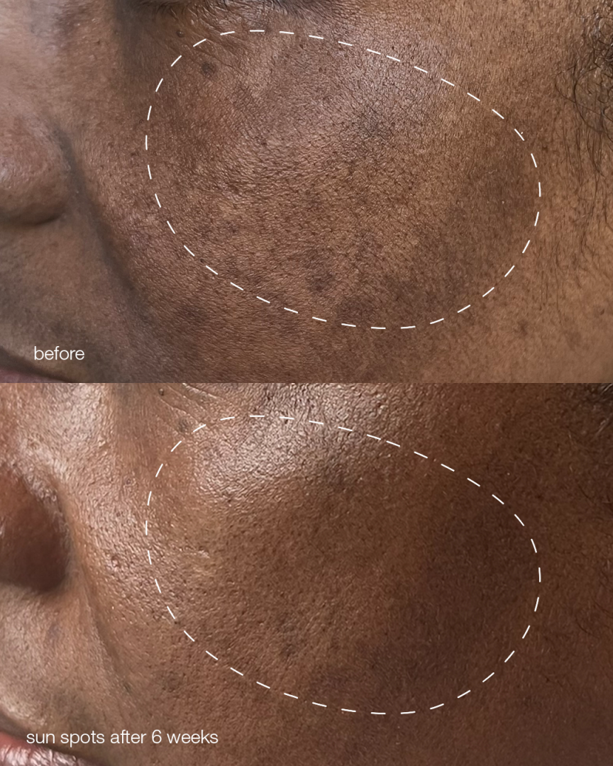 Melanopro - Dermalogica PRO UK